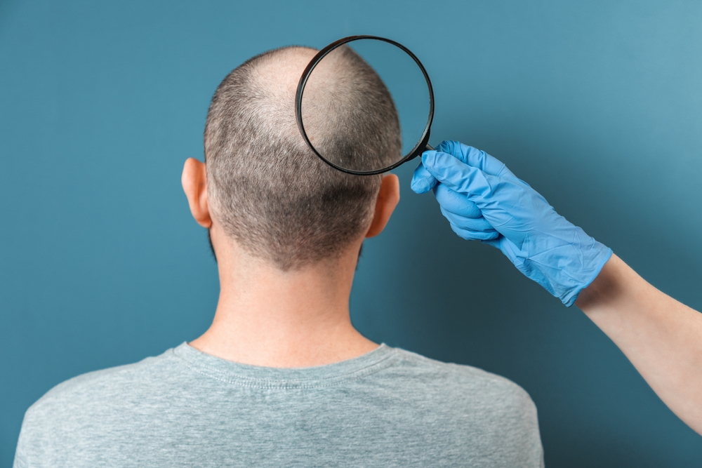 Lassen sich graue Haare rückgängig machen? - Andromenopause
